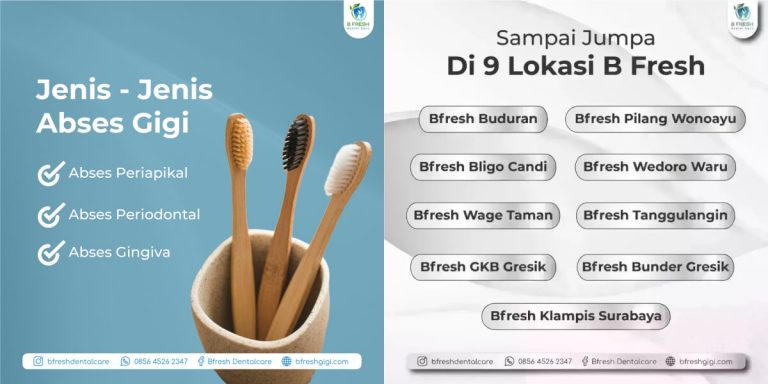Jenis Jenis Abses Gigi - Bfresh Dental Care