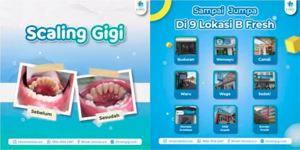 Beranda - Bfresh Dental Care