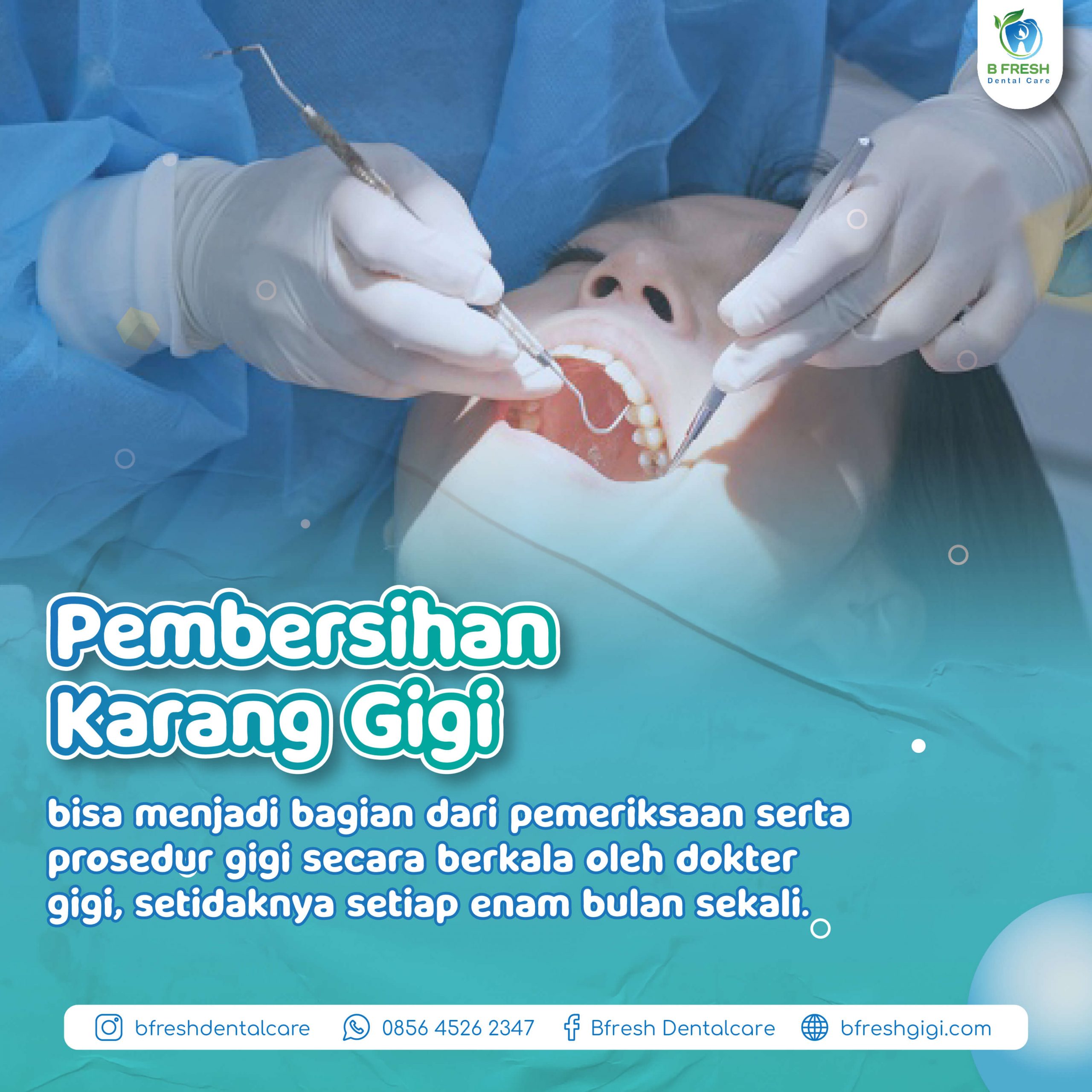 Kenapa Scaling Gigi diperlukan? - Bfresh Dental Care