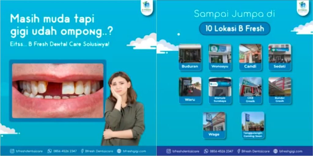 Beranda - Bfresh Dental Care