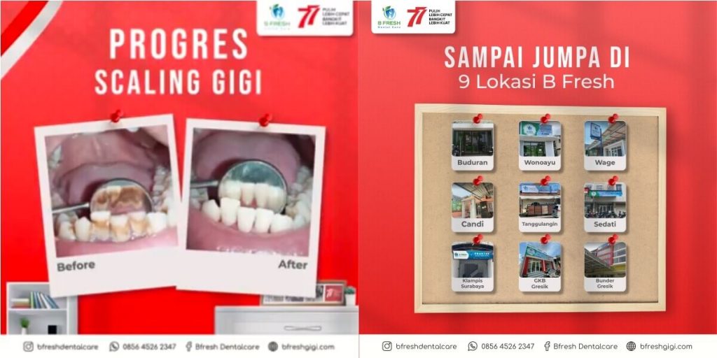 Beranda - Bfresh Dental Care