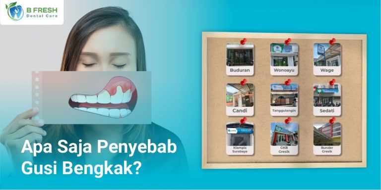 Apa Saja Penyebab Gusi Bengkak? - Bfresh Dental Care