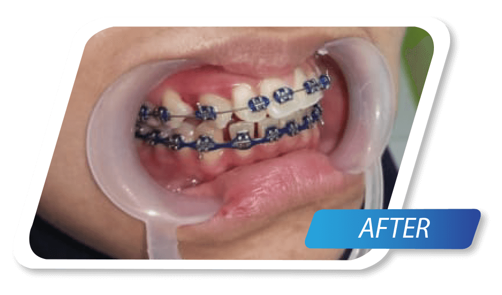 Beranda - Bfresh Dental Care