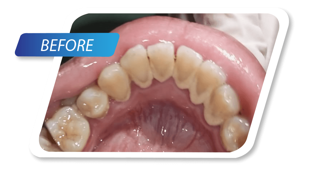 Beranda - Bfresh Dental Care