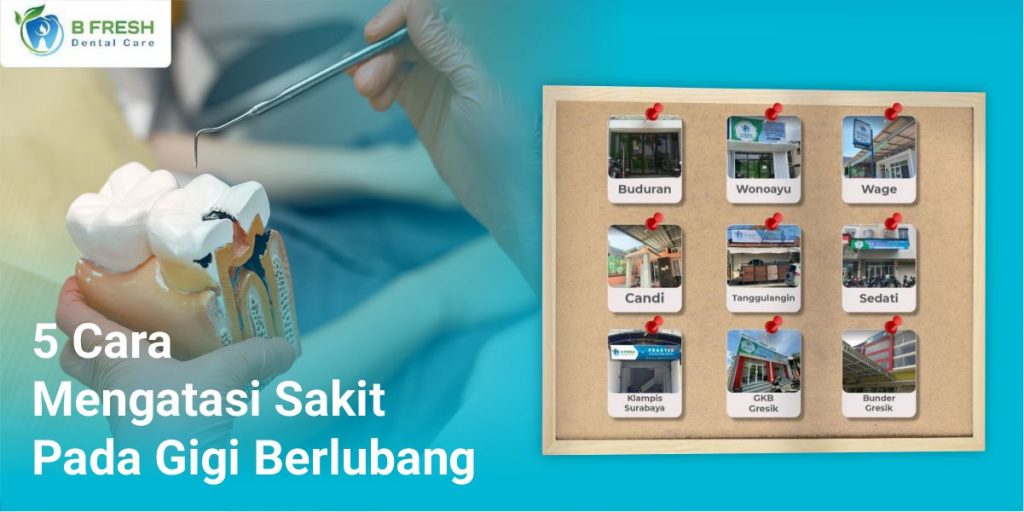 Beranda - Bfresh Dental Care