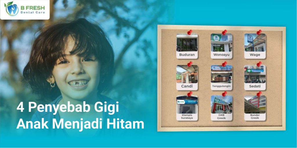 4 Penyebab Gigi Anak Menjadi Hitam - Bfresh Dental Care