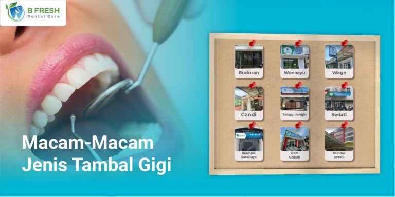 Macam-Macam Jenis Tambal Gigi - Bfresh Dental Care