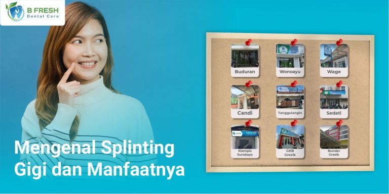 Mengenal Splinting Gigi dan Manfaatnya - Bfresh Dental Care