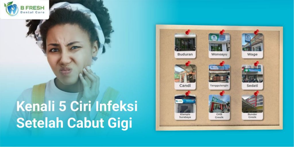 Kenali 5 Ciri Infeksi Setelah Cabut Gigi-Bfresh Dental Care