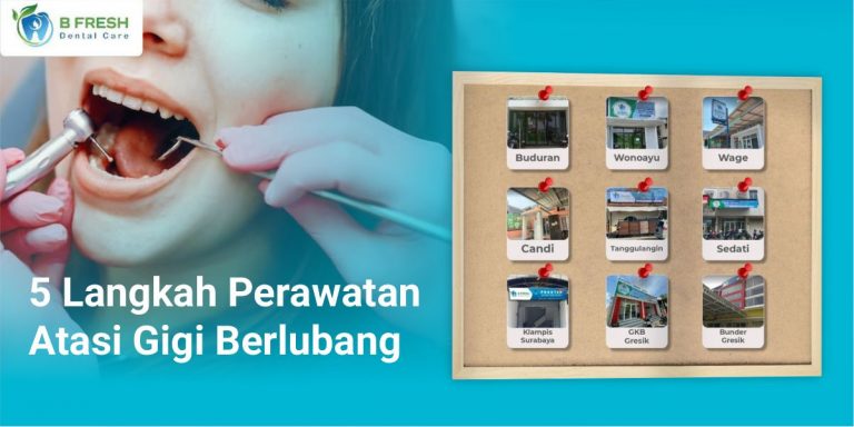 5 Langkah Perawatan Atasi Gigi Berlubang-Bfresh Dental Care