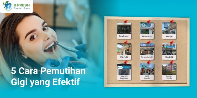 5 Cara Pemutihan Gigi yang Efektif - Bfresh Dental Care