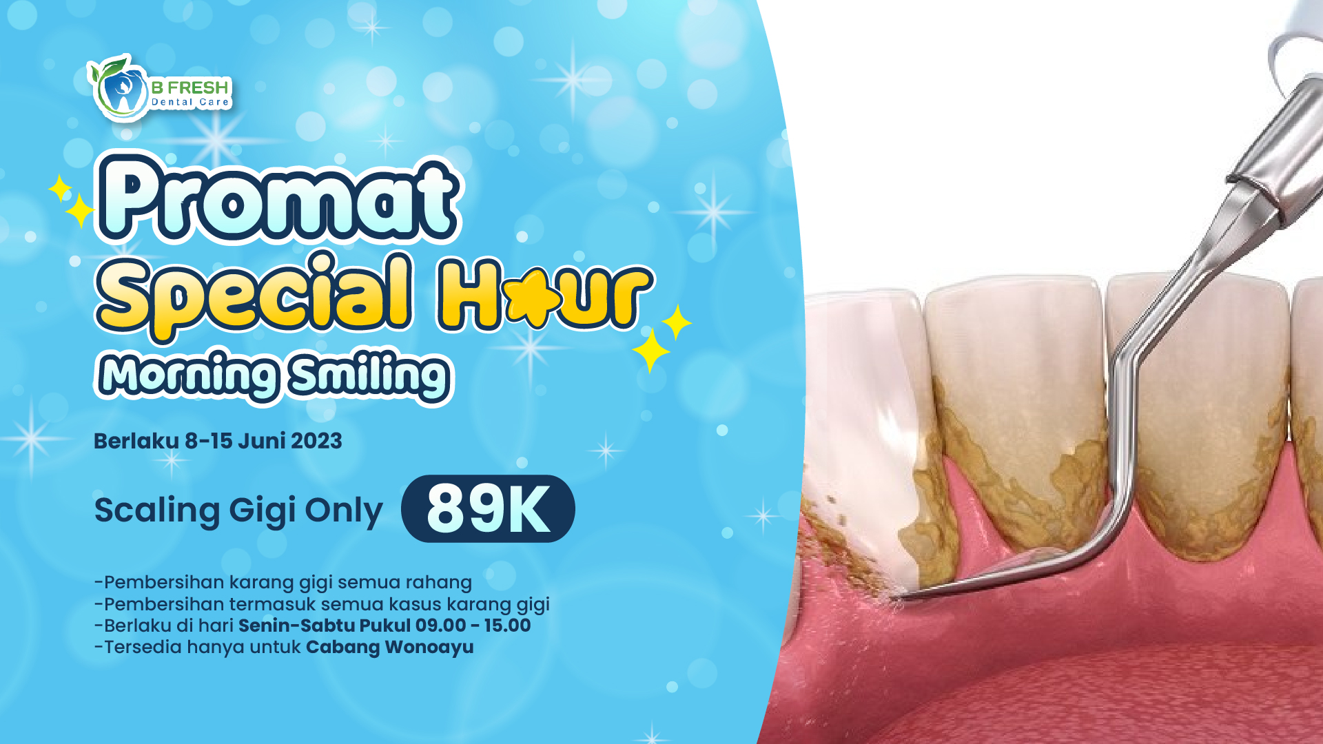 Beranda - Bfresh Dental Care