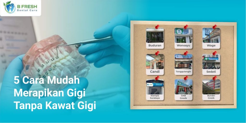 5 Cara Mudah Merapikan Gigi Tanpa Kawat Gigi