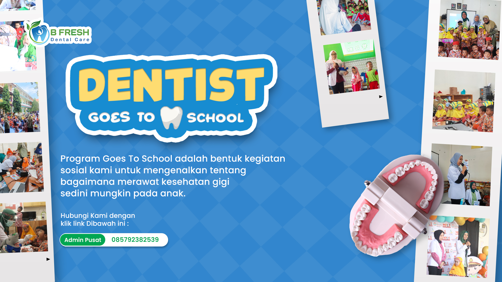 B Fresh Dental Care | Dokter Gigi Sidoarjo Surabaya Gresik Malang Pasuruan