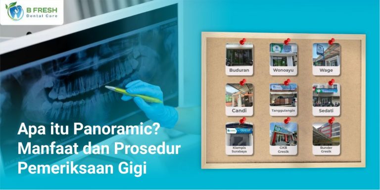 Apa itu Panoramic? Manfaat dan Prosedur Pemeriksaan Gigi